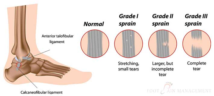 Ankle Problems | Foot Problems