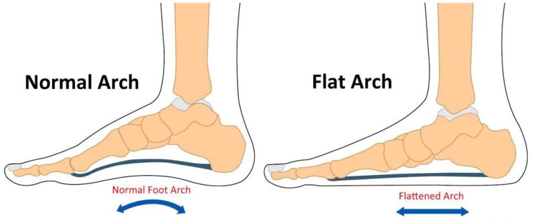 Deformities | Foot Problems